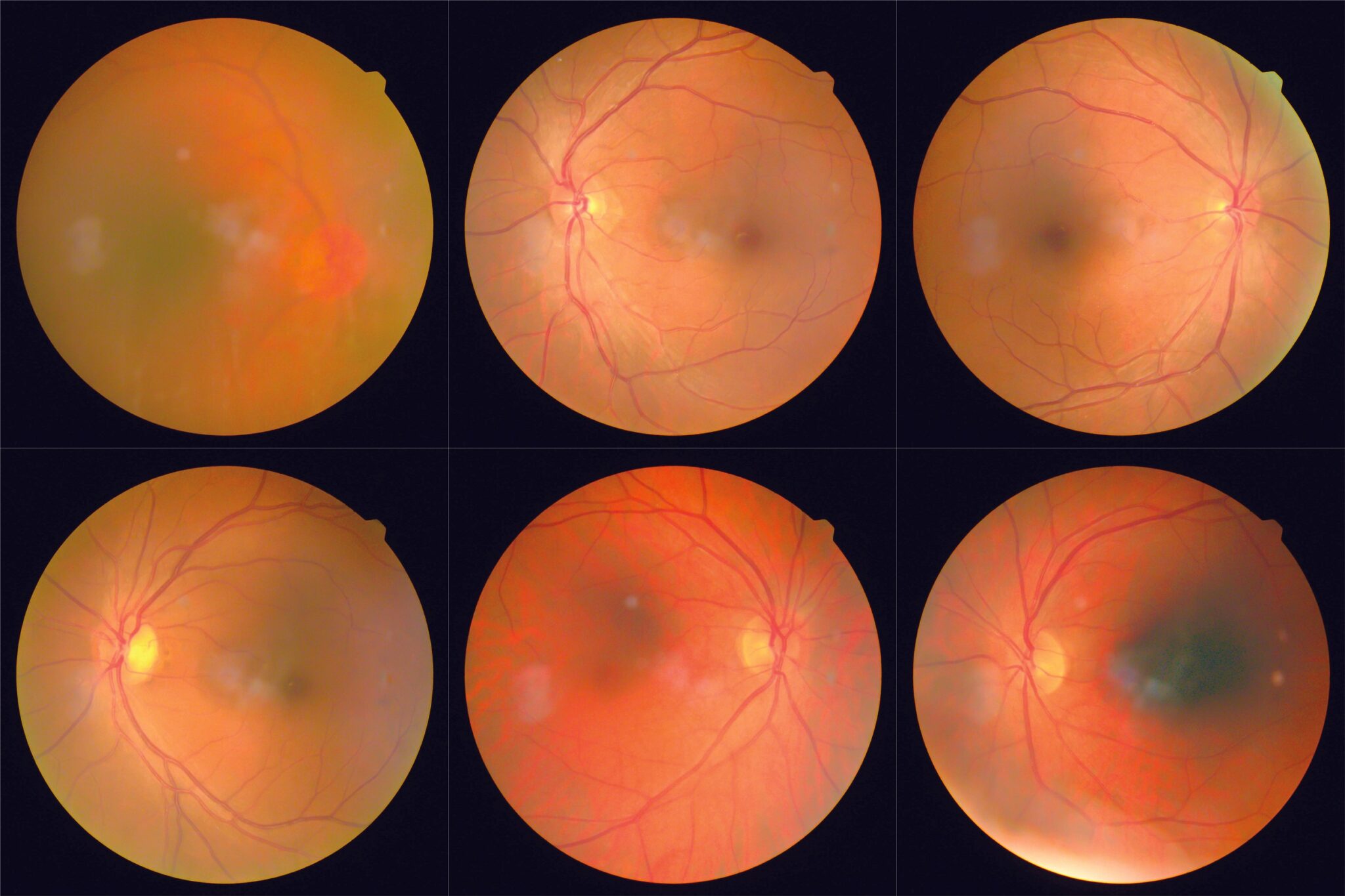 AMD - Optikerforeningen